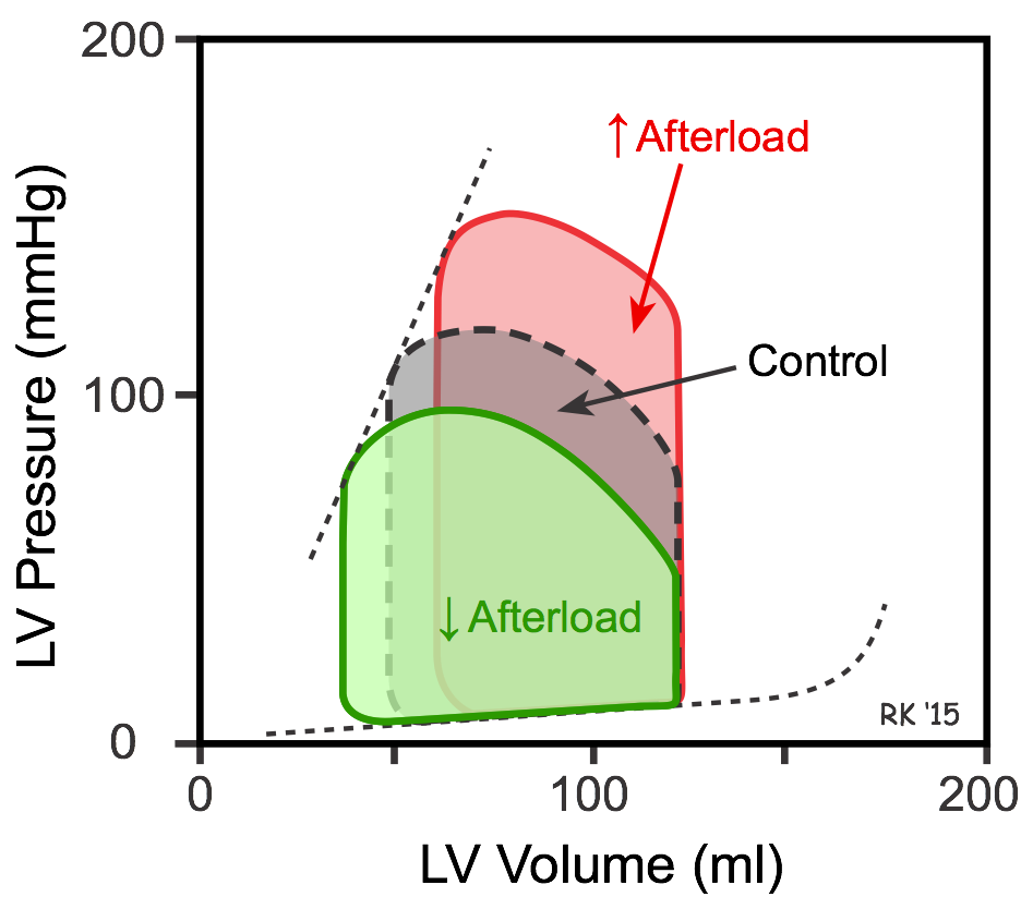 CV Physiology | Effects of Preload, Afterload and Inotropy on ...