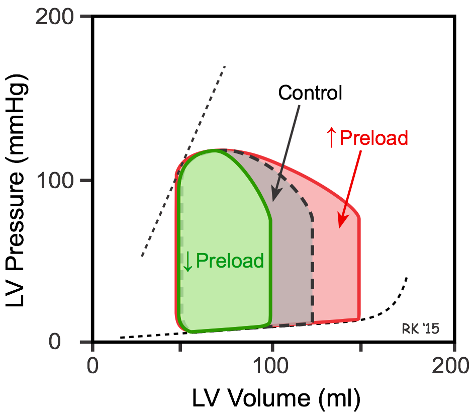 CV Physiology | Effects of Preload, Afterload and Inotropy on ...